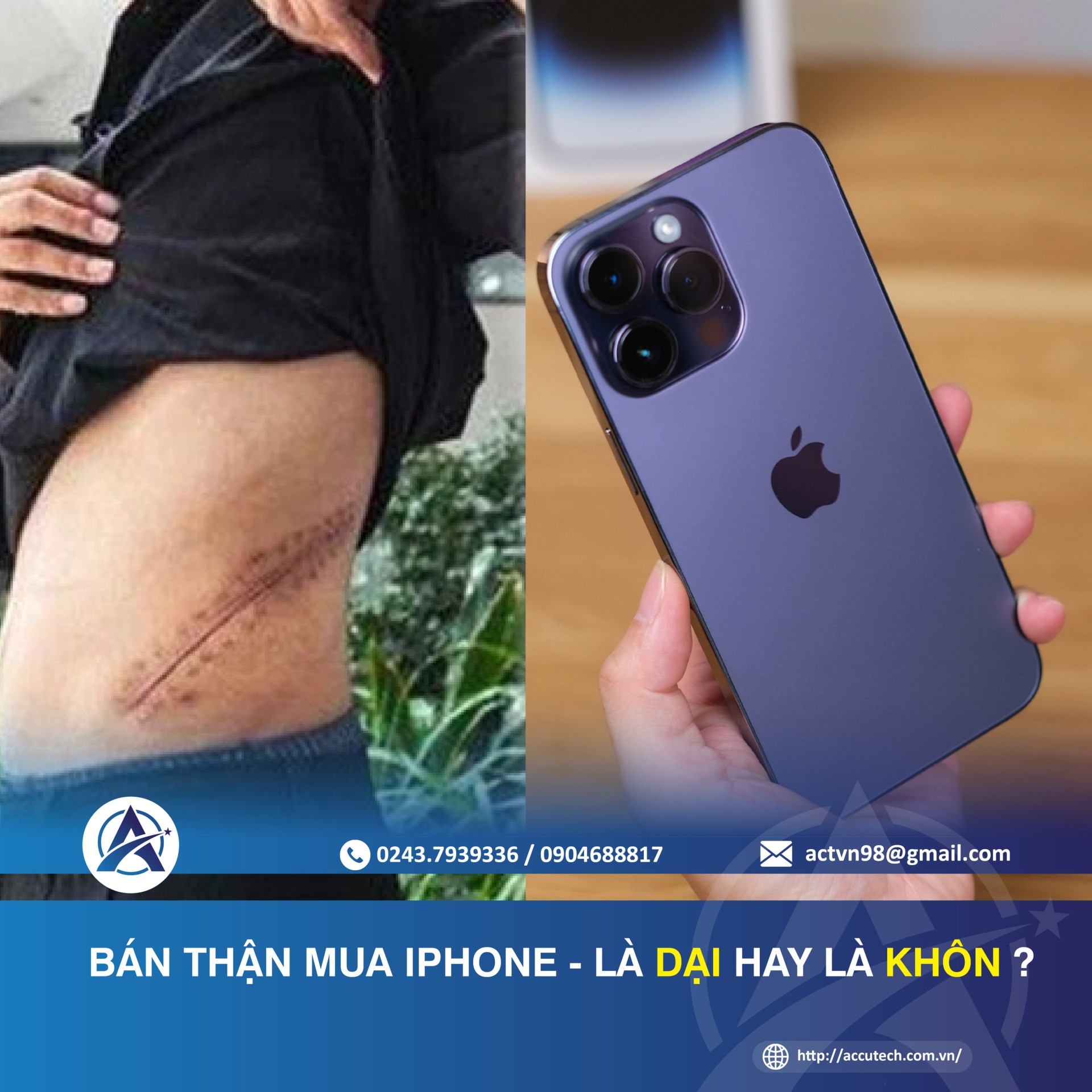 BÁN THẬN MUA IPHONE, LÀ DẠI HAY LÀ KHÔN?