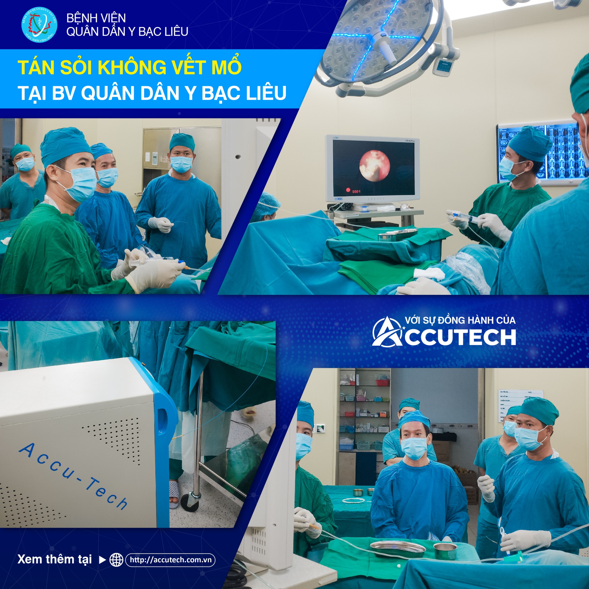 TÁN SỎI KHÔNG VẾT MỔ TẠI BV QUÂN DÂN Y TỈNH BẠC LIÊU - Công ty Cổ Phần Accutech Việt Nam