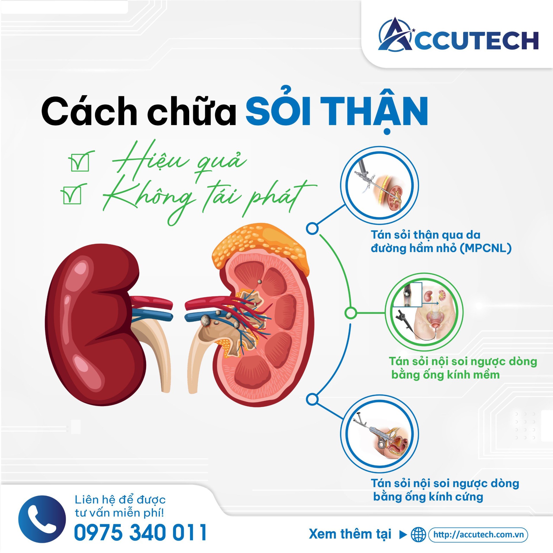 Cách chữa sỏi thận hiệu quả không tái phát - Công ty Cổ Phần Accutech ...