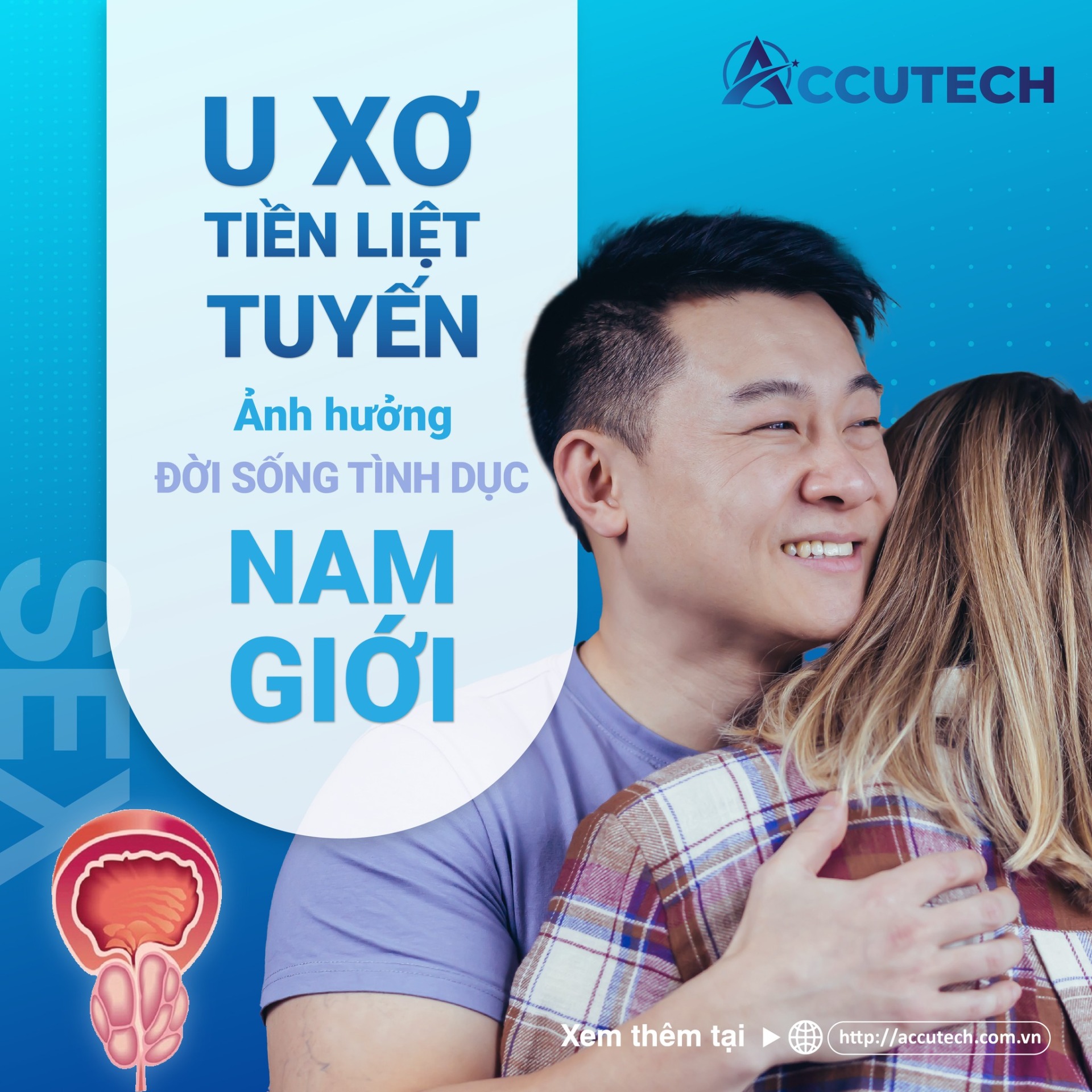 U xơ tuyến tiền liệt có ảnh hưởng đến đời sống tình dục ở nam giới? - Công ty Cổ Phần Accutech ...